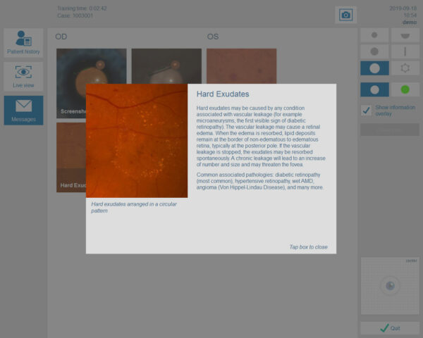 Eyesi Direct - Skope Medical Norge