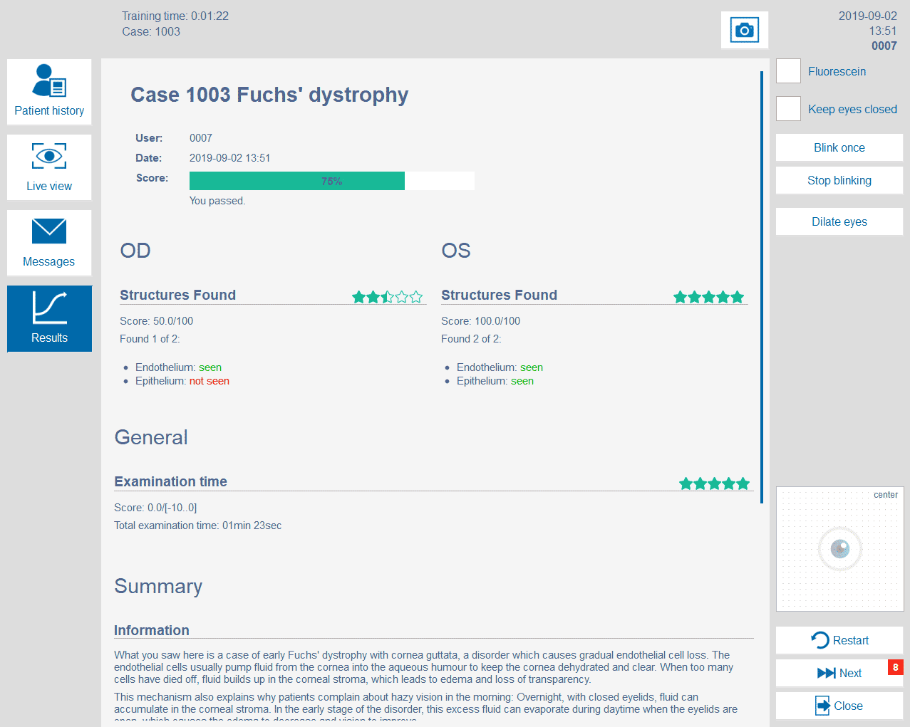 Eyesi Slit Lamp - Skope Medical Norge