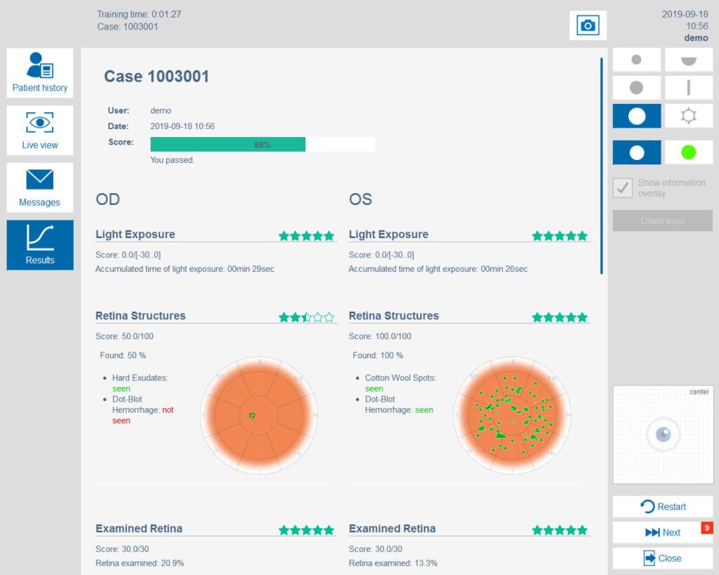 Eyesi Direct - Skope Medical Norge